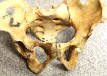 ilearn.courses.med.fiu.edu - /published/Anatomy_Radiology_of_Pelvis ...