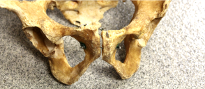 ilearn.courses.med.fiu.edu - /published/Anatomy_Radiology_of_Pelvis ...