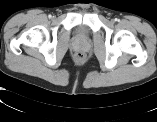 ilearn.courses.med.fiu.edu - /published/Anatomy_Radiology_of_Pelvis ...