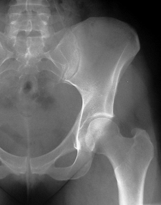 ilearn.courses.med.fiu.edu - /published/Anatomy_Radiology_of_Pelvis ...