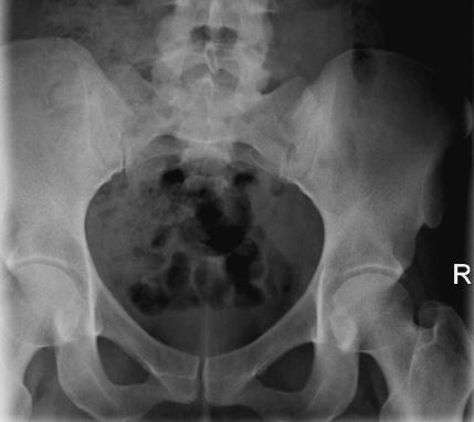 ilearn.courses.med.fiu.edu - /published/Anatomy_Radiology_of_Pelvis ...