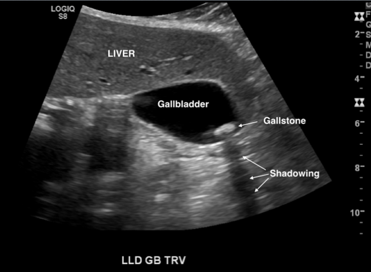 ilearn.courses.med.fiu.edu - /published/Basics_of_Medical_Imaging/mobile/
