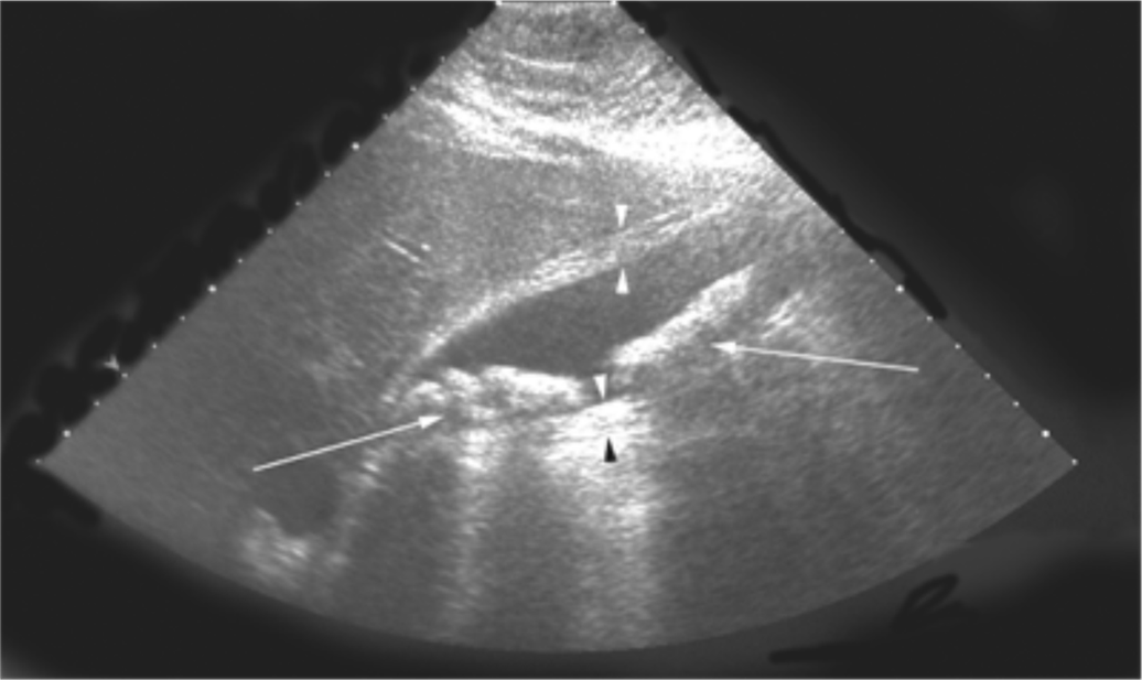 ilearn.courses.med.fiu.edu - /published/Gallbladder_Clinical_Anatomy ...